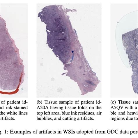 Artifacts In Whole Slide Images Wsis From The Genomic Data Commons