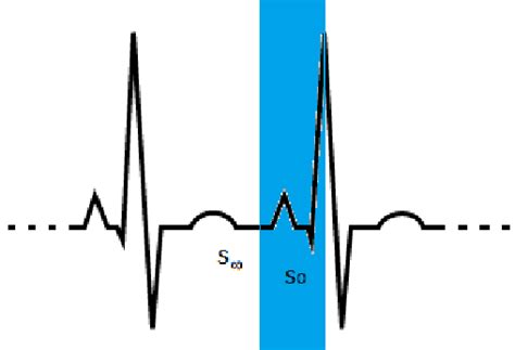 left the figure shows a infinite signal s∞ and s 0 a finite part of