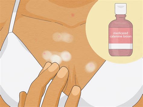 How To Get Rid Of Chest Acne Fast According To Experts