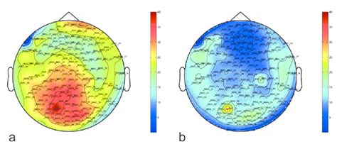 Topographic Distribution Over The Head Of The Power Spectrum In The