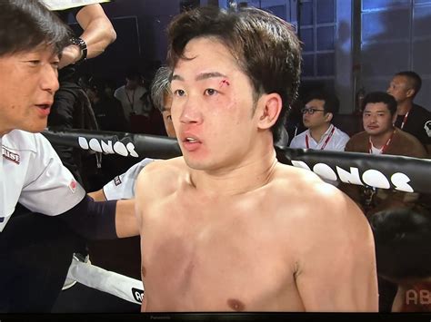 【動画】朝倉未来さん、秒殺ko負けで記憶喪失になってしまう…引退表明へ：アニゲー速報