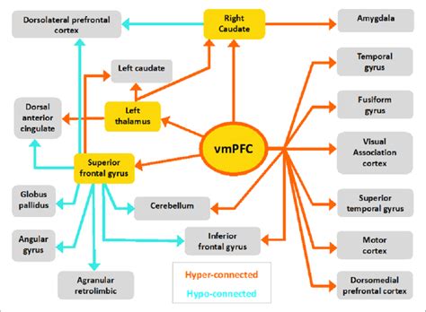 Schematic Map Of Altered Functional Connectivity In Ocd Corresponding