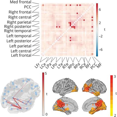 Figure Meg Derived Fc In Patients With Als Vs Hcs Download Scientific