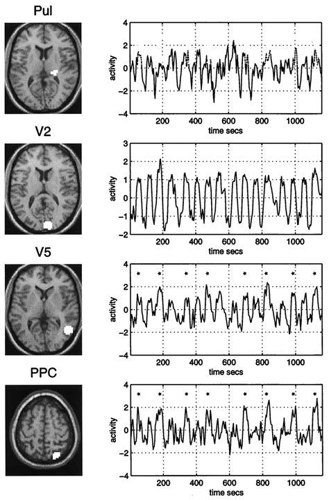 Attentional Modulation Of Effective Connectivity From V2 To V5 Mt In