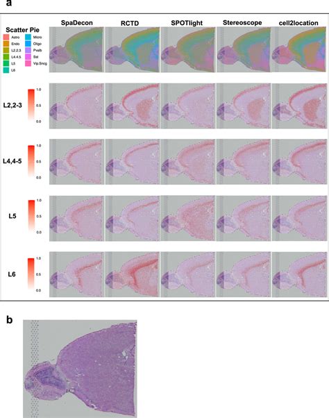 Cell Type Deconvolution Results For 10x Visium Mouse Brain Serial