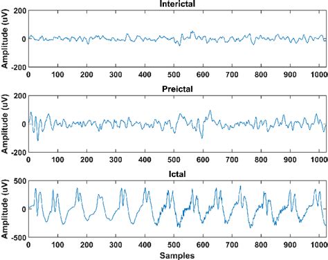 Figure 1 From A Fractal Based Machine Learning Method For Automatic