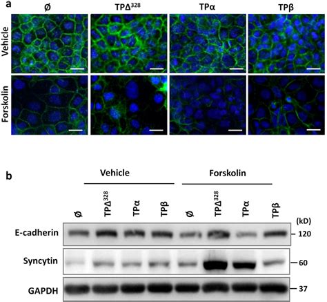 Tpβ Slows And Tpα Enhances The Rate Of Syncytialisation Of Trophoblast