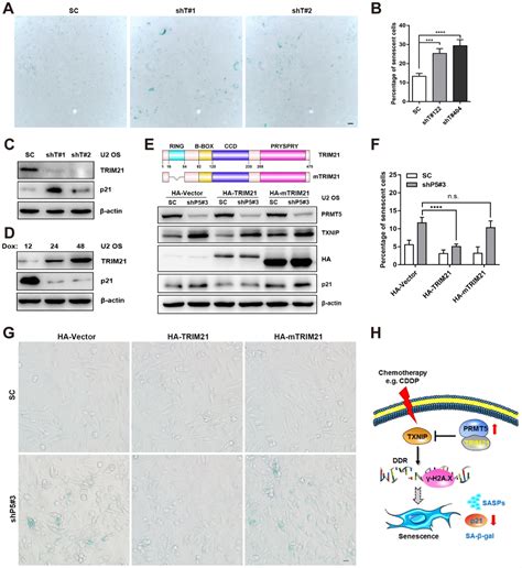 Prmt5 Trim21 Interaction Regulates The Senescence Of Osteosarcoma Cells
