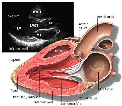 Making Sense Of An Echocardiogram Report For Gps — Cardiology Institute