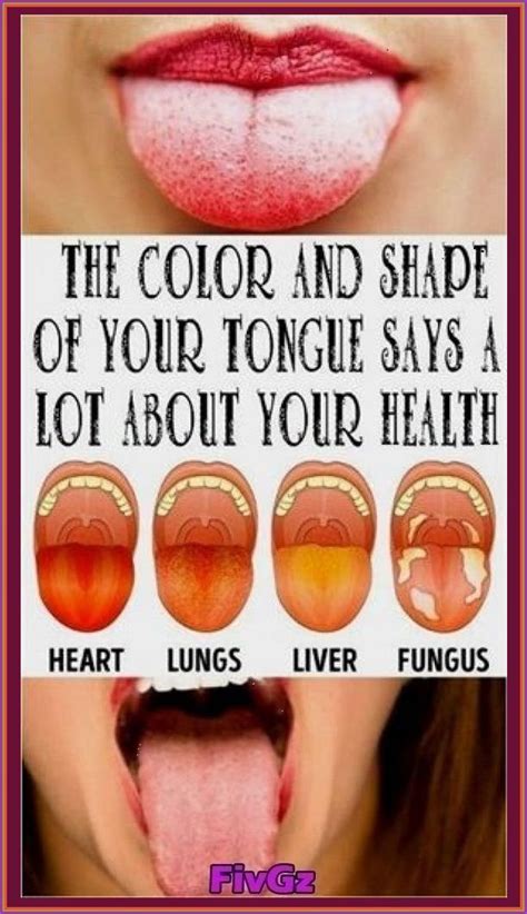 What Does Your Tongue Say About Your Health Artofit
