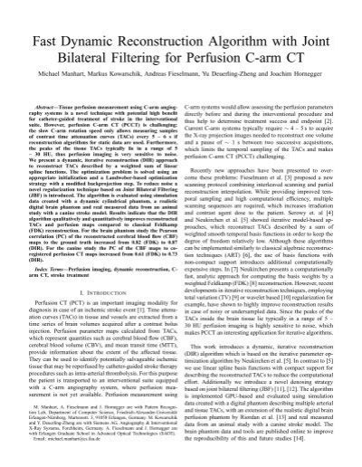 Fast Dynamic Reconstruction Algorithm With Joint Bilateral Filtering