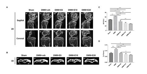 Micro Computed Tomography Micro Ct Analysis Of The Medial Subchondral