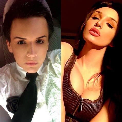 23 years old 2 years in hrt pellets ffs and breast augmentation before