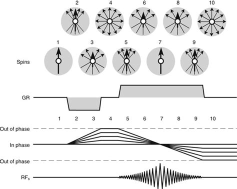 Steady State Gradient Echo Imaging Radiology Key
