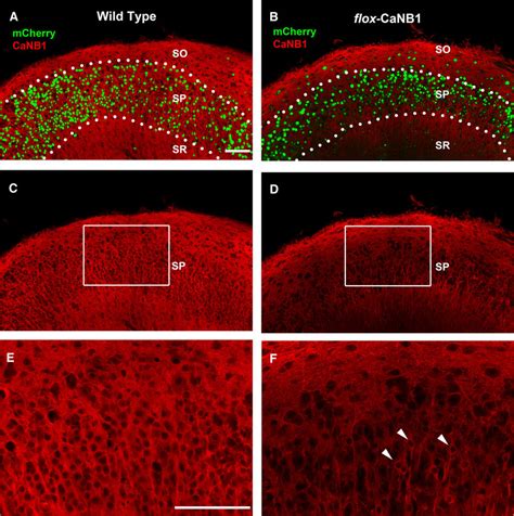 Transfection With Raav8 Hsyn Mcherry Cre In An Fcanb1 Mouse Slice