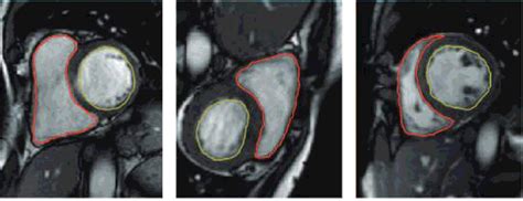 opencv how to overlay segmented image on top of main