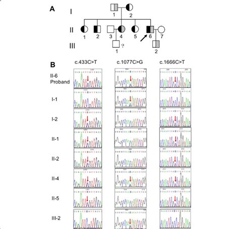 Genetic Analysis Of Slc12a3 Mutations In The Pedigree Of Gitelman