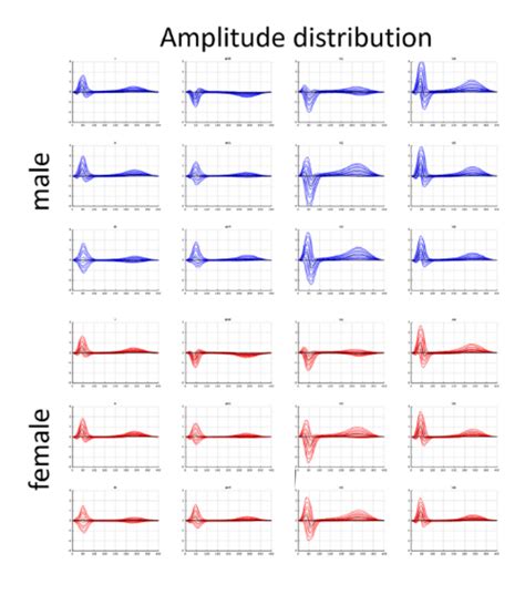 Ecg Waveforms Tell More Than Amplitudes Ecg Excellence
