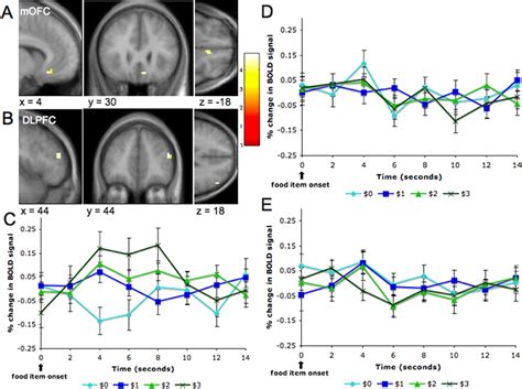 Orbitofrontal Cortex Encodes Willingness To Pay In Everyday Economic