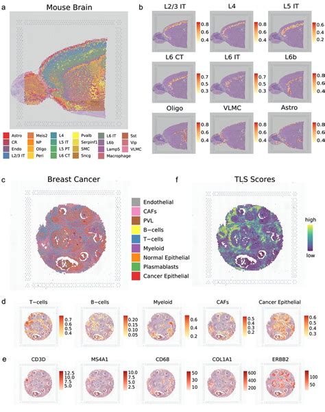 Uniport Identifies Iconic Structure In Spatial Transcriptomic Data 10x