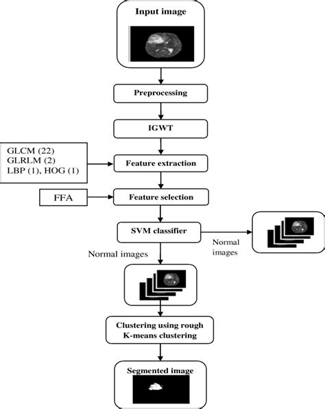 Proposed Brain Mri Image Tumor Segmentation Download Scientific Diagram