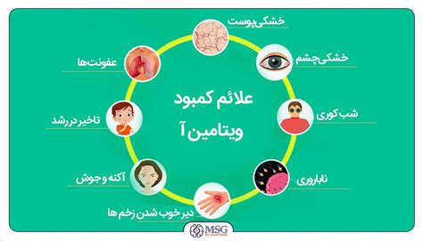 علائم کمبود ویتامین آ در بدن مقدار مصرف قرص ویتامی آ چقدر است؟ مای