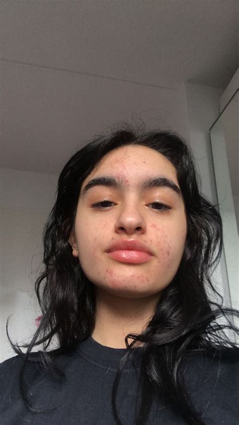 Pin By Itisokg On Body Safe Space Girl With Acne Pretty Skin Body