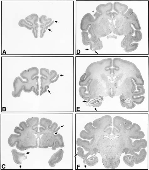 Figure 1 From Interaction Of Ventral And Orbital Prefrontal Cortex With