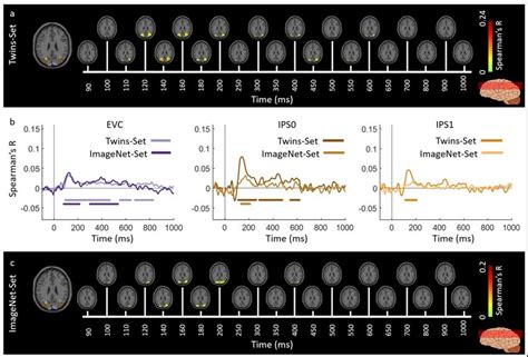 Spatiotemporal Neural Dynamics Of Vision In Dorsal Stream A An Axial