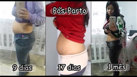 Recuperação Pós Parto Cesária Como Ficou Minha Barriga Youtube