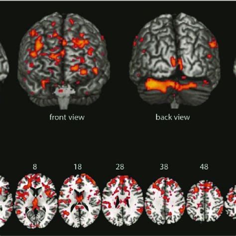 Results Of The Whole Brain Intraclass Correlation Coefficient Icc