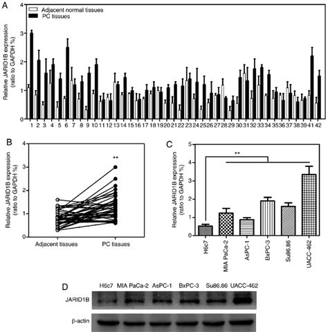 The Expression Of Jarid1b Is Increased In Pc A Quantification Of
