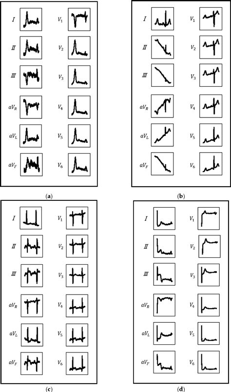Figure 3 From End To End Convolutional Neural Network Model To Detect