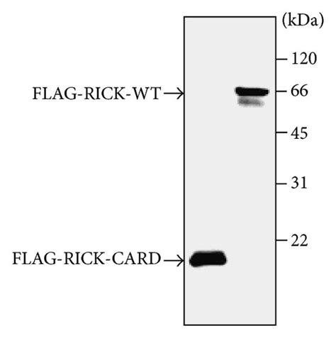Schematic Representation Of Nod2 And Rick And Sequencing Chromatograms