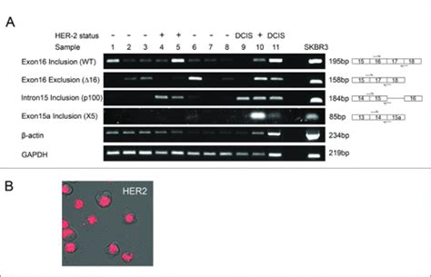 Full Article Srsf3 And Hnrnp H1 Regulate A Splicing Hotspot Of Her2 In