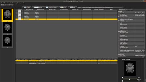 mri file manager irmage