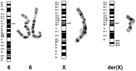 Partial Karyotypes And Schematics For Normal Chromosomes 6 X And The