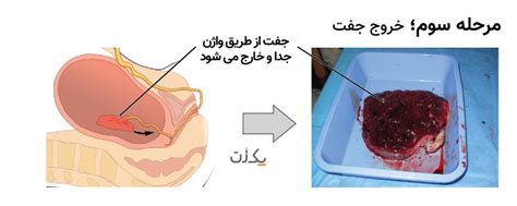 مراحل زایمان طبیعی آموزش زایمان طبیعی یک زن