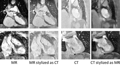 Figure 1 From Synergistic Image And Feature Adaptation Towards Cross