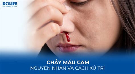 Chảy Máu Cam Nguyên Nhân Và Cách Xử Trí Bệnh Viện Quốc Tế Dolife