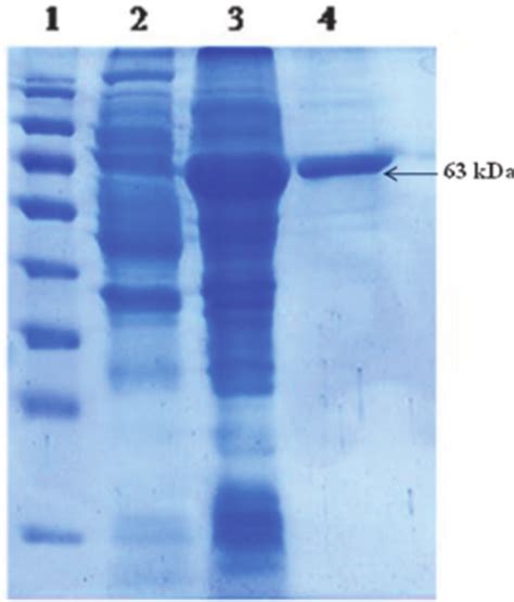 Sds Page Analysis Of Recombinant Expression And Purification Of Fusion