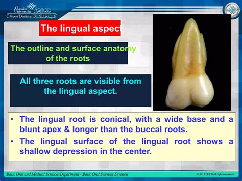 Image result for Maxillary First Molar