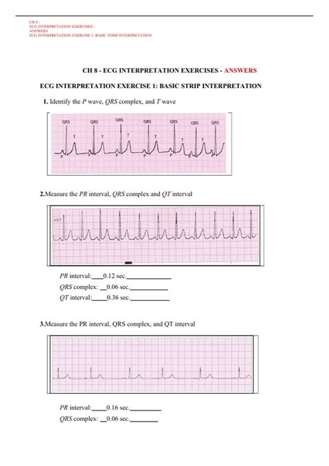 Image result for ECG Reading Practice