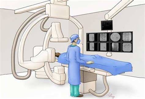 Image result for Spinal Angiogram