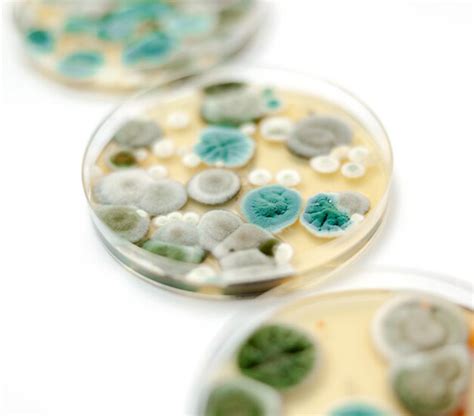 Image result for Mold Air Sampling Plating