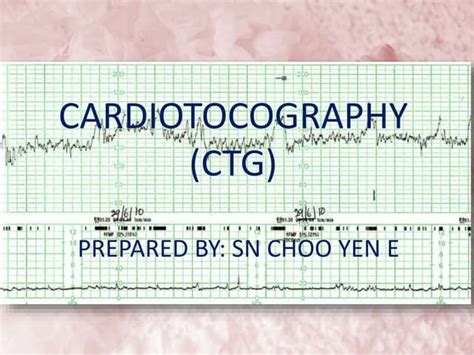 Image result for CTG and Partogram