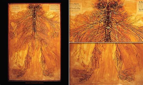 Image result for Nervous System Dissection
