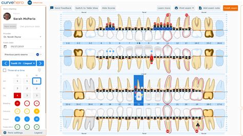Image result for How to Read a Perio Chart
