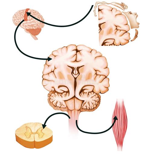 Image result for Extrapyramidal Rigidity Icon