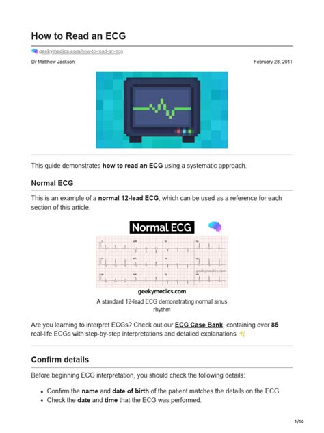Image result for ECG Reading Practice